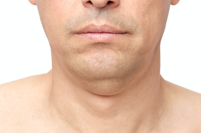 Understanding Weak Chins: Causes, Effects, and Solutions for a Stronger Jaw